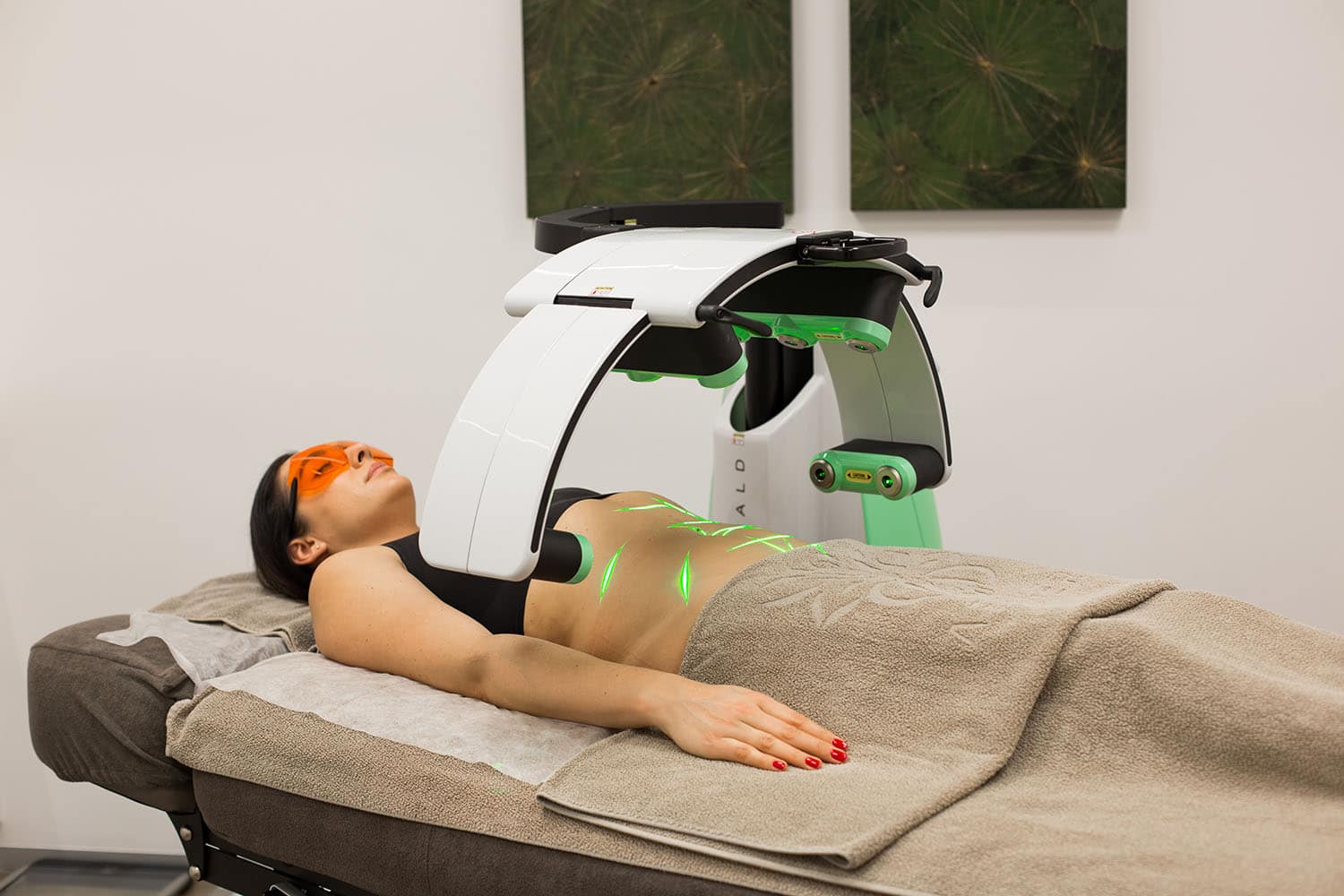 Emerald Laser Fat Loss Treatment Winchester | Non-Surgical